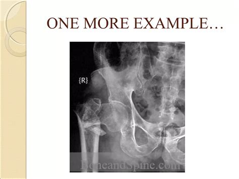 Basics Of Orthopedic Radiology Ppt