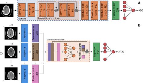 Examination Level Supervision For Deep Learning Based Intracranial