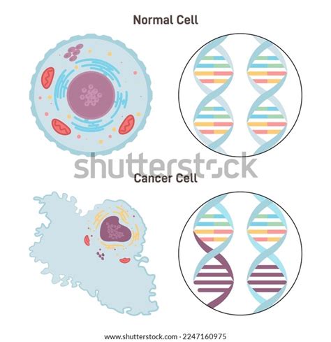 Normal Cancer Cells Difference Between Healthy Stock Vector Royalty Free 2247160975 Shutterstock