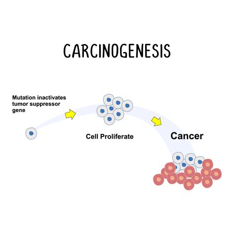 Carcinogenesis The Process Of Cancer Development 23108006 Vector Art At Vecteezy