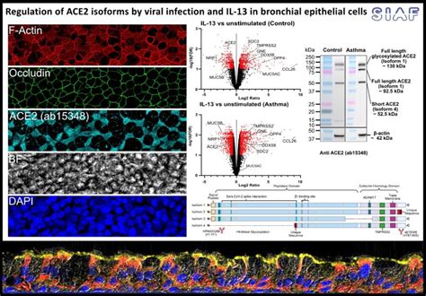 Ace2 Epithelial Cells Sarscov2 Covid19 Interleukin13