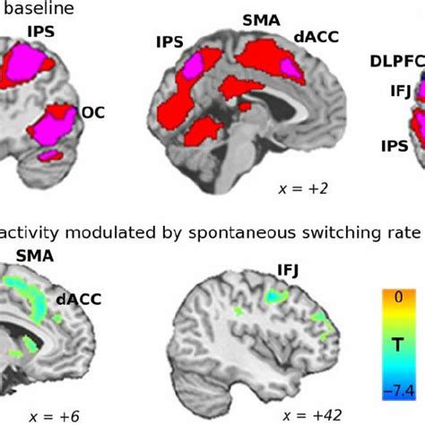 A Brain Activation For Task Switching Red And Distractor Inhibition Download Scientific