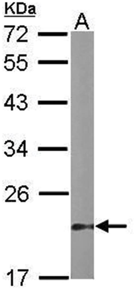 Dusp3 Polyclonal Invitrogen 100µl Unconjugated