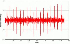 Example Of Impulse Noise As Seen In The Time Domain Multiple Impulses Download Scientific