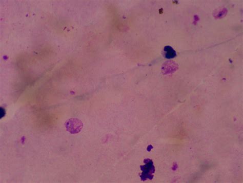 Andrew Malaria Project Object Detection Dataset By Andrewsteve