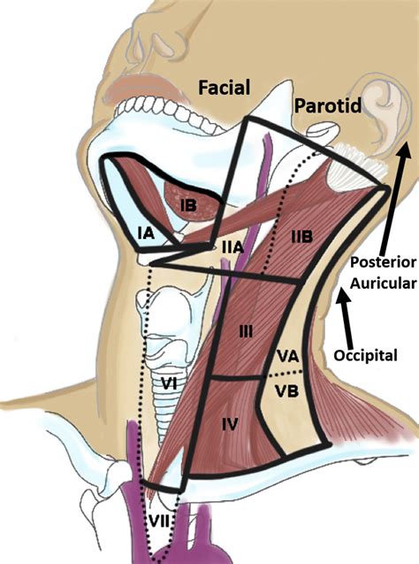 Ultrasonography Of Cervical Lymph Nodes Radiologic Clinics