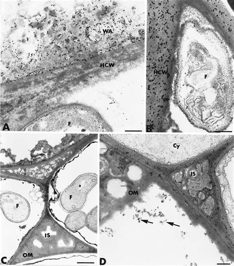 Transmission Electron Micrographs Of Pythium Oligandrum Inoculated Download Scientific Diagram