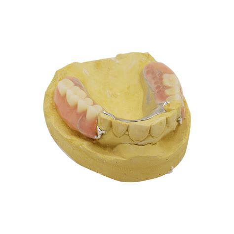 Istar Dentures Clasps For Stability