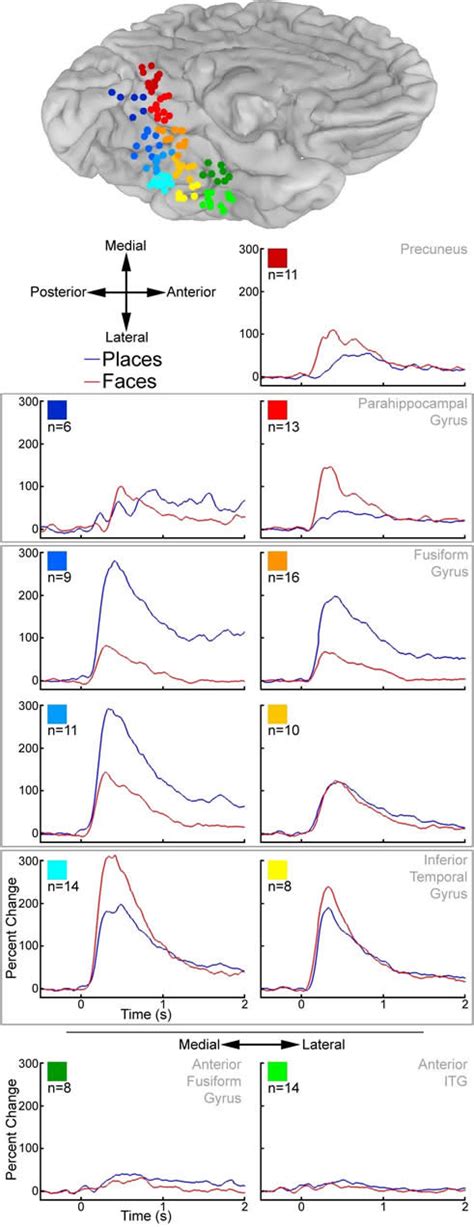 Electrocorticography Of Face And Place Specificity During Visual Naming