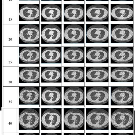 Original Lung Ct Images Output Lung Ct Images After Applying Various
