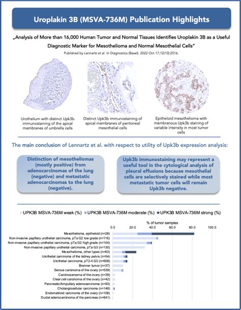 Uroplakin 3b Is A Highly Specific Marker For Normal And Neoplastic Mesothelial Cells