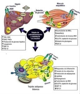 Resistencia A La Insulina Endocrinología Reproductiva Glucosa