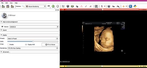 D Ultrasound DICOM Import Error Reference Image In Series Does Not Contain Geometry