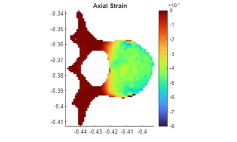 Medical Image Based Finite Element Analysis Of Spine Matlab And Simulink