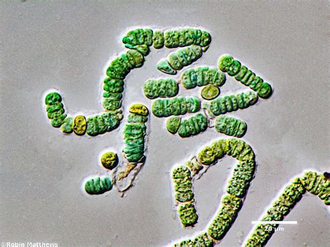 Nodularia Bornet Et Flahault