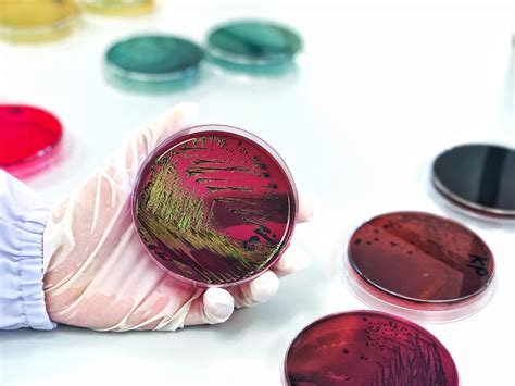 Understanding Chromogenic Culture Media