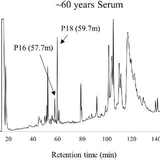 Isolation Of Peptides From Human Serum RP HPLC Chromatogram Of The Download Scientific Diagram