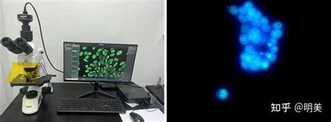 显微镜下的肺炎支原体 知乎