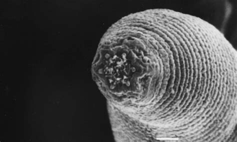 Close Up Of Earthworm Mouth Under Microscope