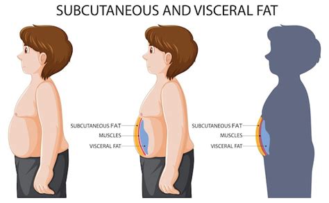 Free Vector Subcutaneous And Visceral Fat Diagram