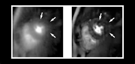 1 Potential Presence Of Artefacts In The Raw Data An Example