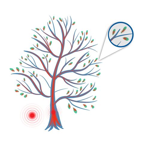 Precision Neuromodulation For Targeted Therapy Juniper Biomedical