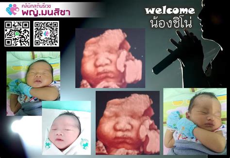 🎉 ยินดีต้อนรับ “น้องชิโน่” นะคะ 🎉 🎀 อัลตราซาวน์ 3 มิติ 4 มิติ ทำให้พ่อแม่สามารถเห็นลูกน้อยได้