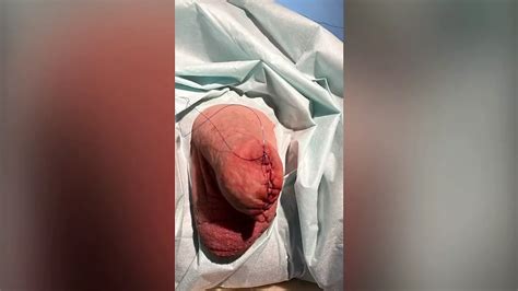 Cock Sewing Amateur Amateur Porn Xhamster