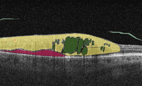 Role Of Ai Image Interpretation For Pathologies Detection