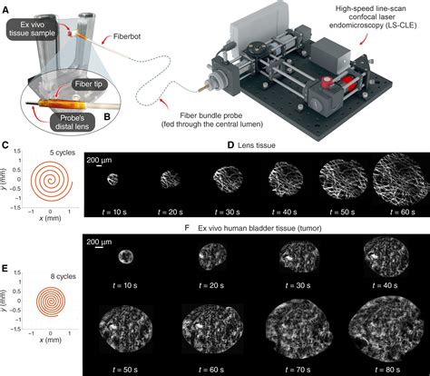 Fiberbots Robotic Fibers For High Precision Minimally Invasive Surgery Science Advances