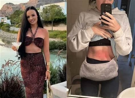 스테이크 먹고 3일 통증”맹장염인가 했는데 20대女 ‘이 병 진단 뭐길래