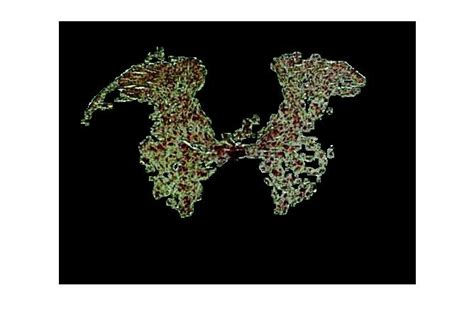 Matlab Remove Small Edges And Simplify An Histology Image Stack Overflow