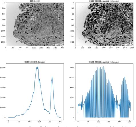 Figure 2 From Automated Detection And Classification Of Oral Squamous Cell Carcinoma Using Deep