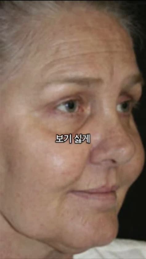 더왈츠클리닉 The Walts 이중턱 방치하면 큰일나는 이유 이중턱 이중턱없애기 이중턱리프팅 이중턱관리 더왈츠 강남피부과 더왈츠의원 강남역피부과 강남