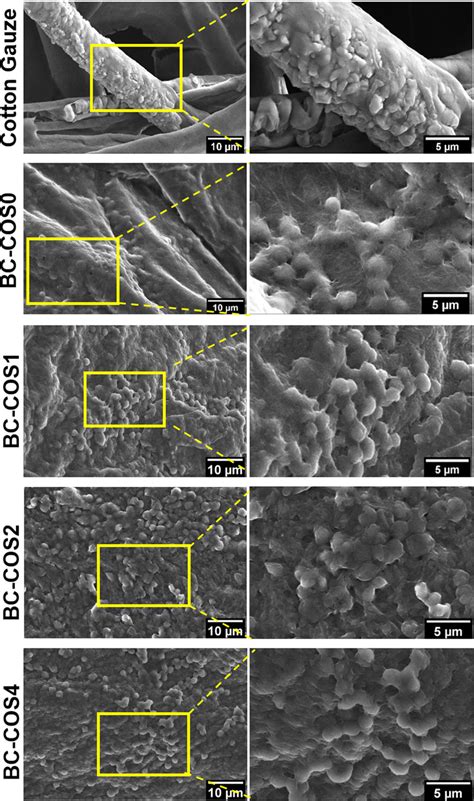 Platelet Aggregation Adhesion On Standard Cotton Gauze And Bc Cos Samples Download Scientific