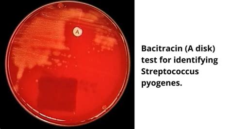 Bacitracin Susceptibility Test Principle Procedure Result Biology Notes Online