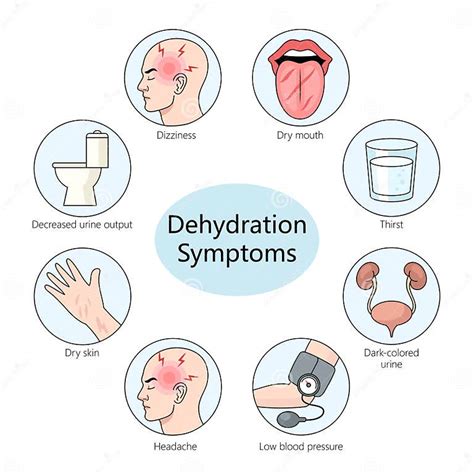 Dehydration Symptoms Diagram Medical Science Stock Vector