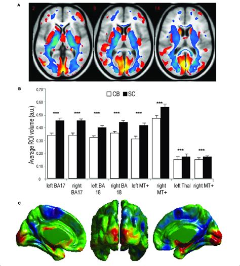 Anatomy Of The Visual System In Congenital Blindness A Voxel Based Download Scientific