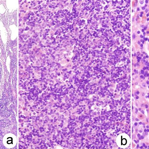 The Histopathology Of The Lymph Node The Paracortical Area Of The Download Scientific Diagram