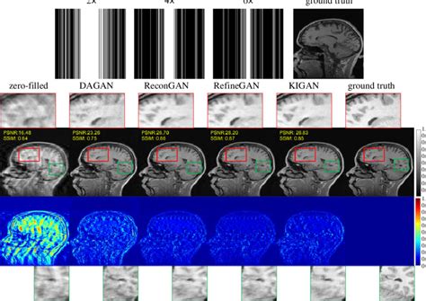 Reconstruction Results Of An Example Brain Mri Dataset By Various Download Scientific Diagram