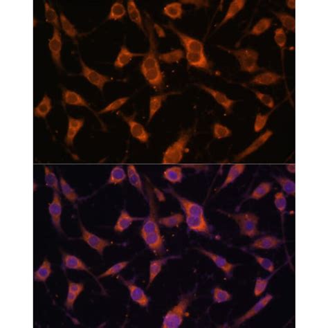 Anti Fibulin 5 Antibody A12432