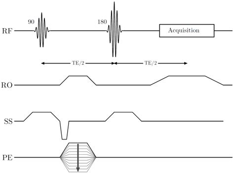 4 Spin Echo Sequence Diagram The Readout Ro Slice Selection Ss
