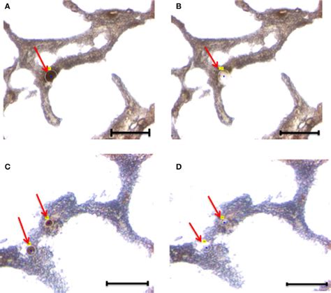 Laser Capture Microdissection Of Astrocytes Eight Micrometers Brain Download Scientific