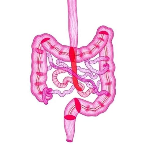 Tissue And Sex Shape Colorectal Cancer Gene Risk