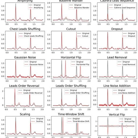 Data Augmentation Schemes Including Lead Ii Download Scientific