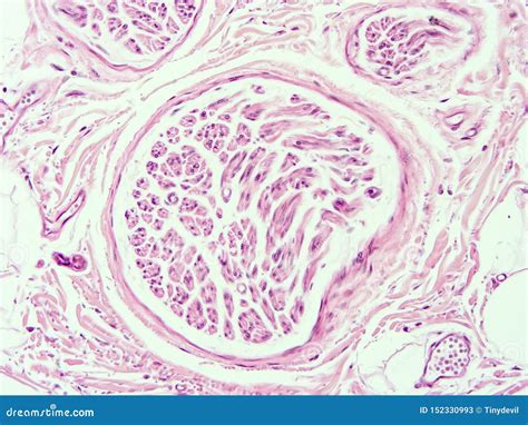 Histology Of Human Adipose Tissue Stock Image Image Of Show