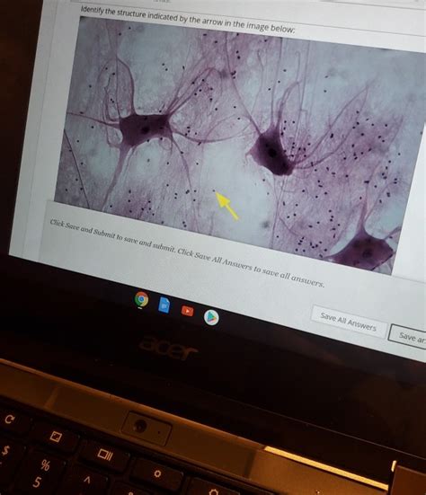 Solved Identify The Structure Indicated By The Arrow In The