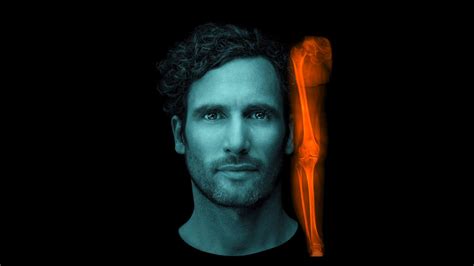 Multitom Rax In Clinical Use Siemens Healthineers