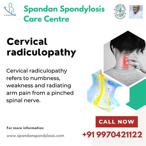 Cervical Radiculopathy At Rs 3000 In Bengaluru Id 2849570874912