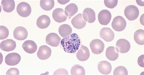 Plasmodium Slide Labeled Plasmodium Slide Labeled